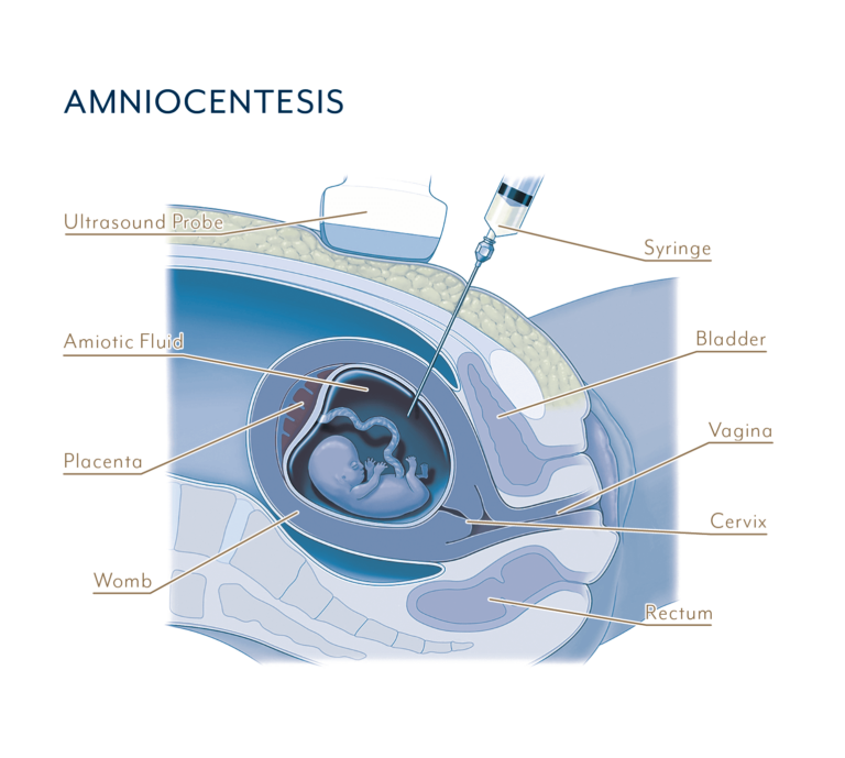 Pregnancy Scans Gold Coast: Expert Fetal Imaging & Care